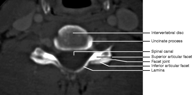 Vertebral Column | SpringerLink