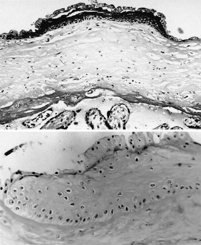 Anatomy and Pathology of the Placental Membranes | SpringerLink