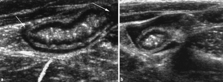 Bildgebung | SpringerLink