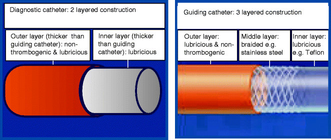 Guiding Catheters | SpringerLink