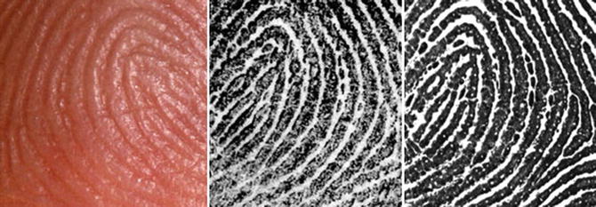 Anatomy of Friction Ridge Skin | SpringerLink