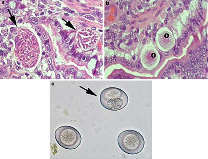 Cystoisospora | SpringerLink