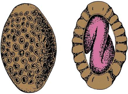 Dioctophyme renale | SpringerLink