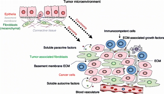 Desmoplasia | SpringerLink