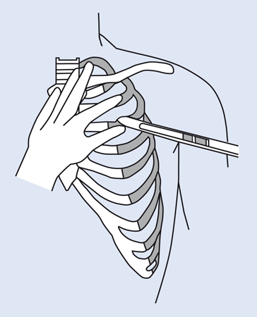 Beschwerden und Erkrankungen in der Thoraxregion, kardiale Störungen ...