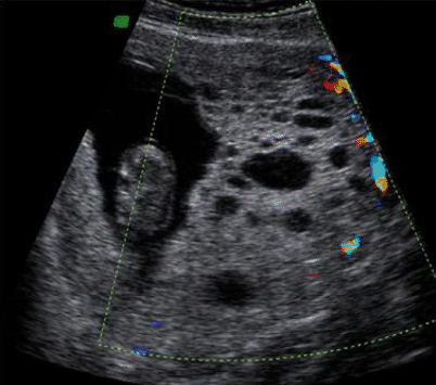 Embryologie und Frühschwangerschaft | SpringerLink