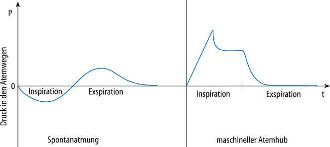Beatmungsformen: Übersicht | SpringerLink