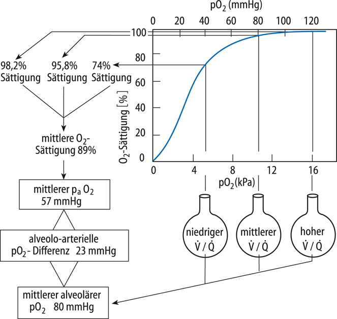 Respiratorische Insuffizienz – Allgemeine Pathophysiologie | SpringerLink