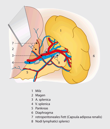 Chirurgische Erkrankungen der Milz | SpringerLink