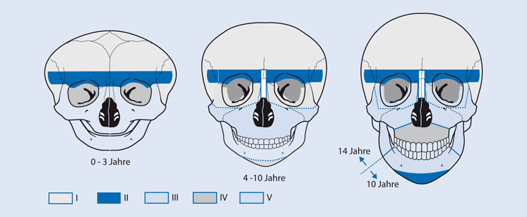 Kraniofaziale Anomalien | SpringerLink