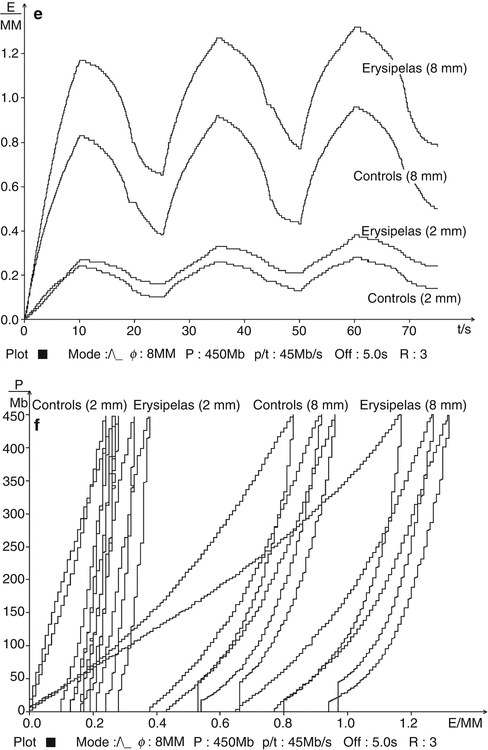 Cutometer® | SpringerLink