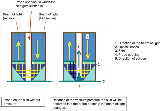 Cutometer® | SpringerLink