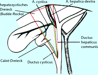 Individualisierte Chirurgie der benignen Gallenblasen- und ...