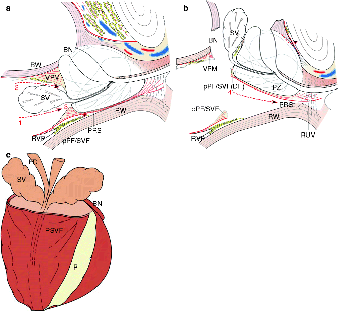 Surgical Anatomy of the Prostate for Radical Prostatectomy | SpringerLink
