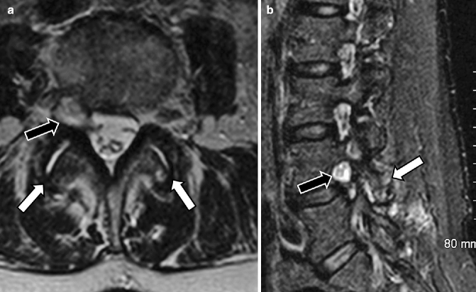 Radiologic Imaging of the Spine | SpringerLink