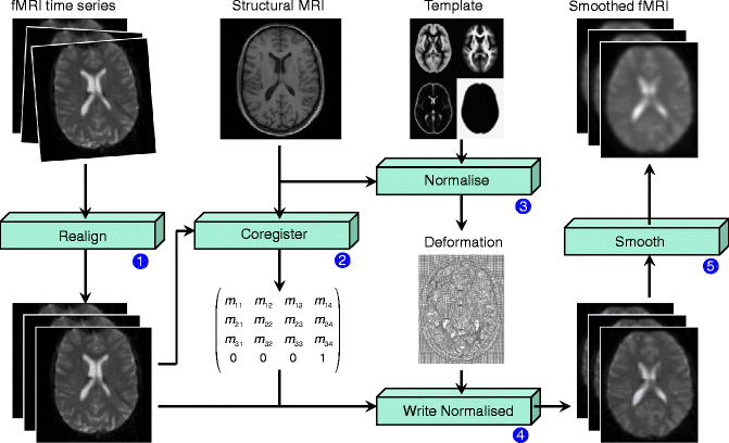 Fmri Data Analysis Using Spm Springerlink