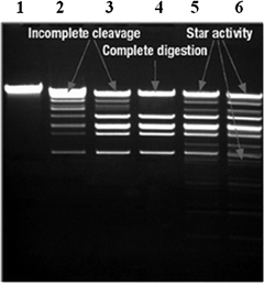 Restriction Enzymes and Their Role in Microbiology | SpringerLink