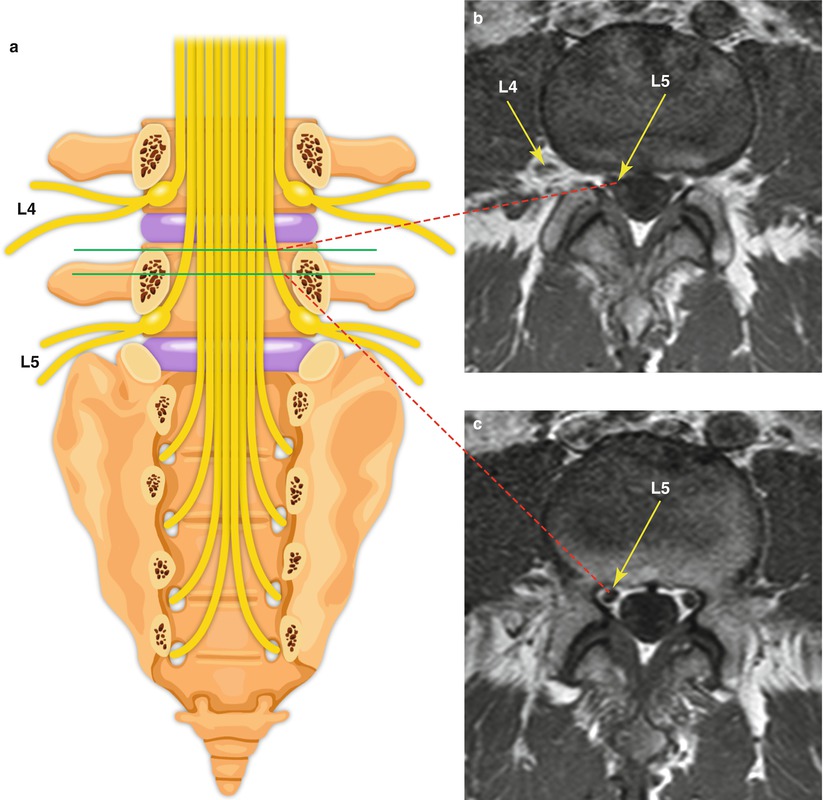 Anatomic Considerations of the Spine | SpringerLink