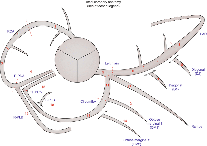 Atherosclerotic Coronary Artery Disease | SpringerLink