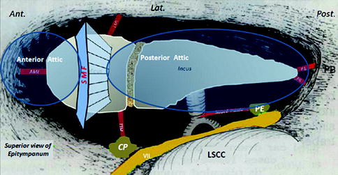 Middle Ear Compartments | SpringerLink