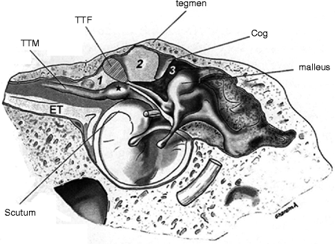 Middle Ear Compartments | SpringerLink