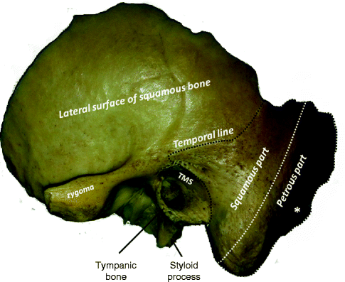 The Mastoid | SpringerLink