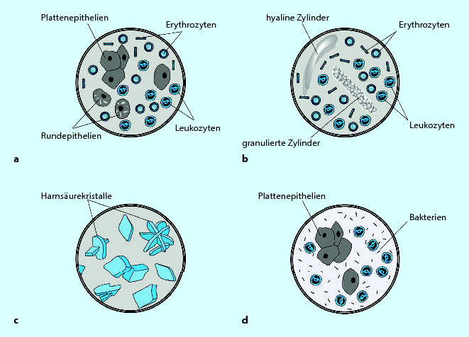 Krankheiten der Nieren, der ableitenden Harnwege und der ...