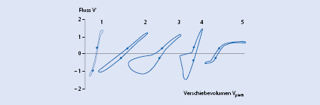 Lungenfunktionsprüfung | SpringerLink