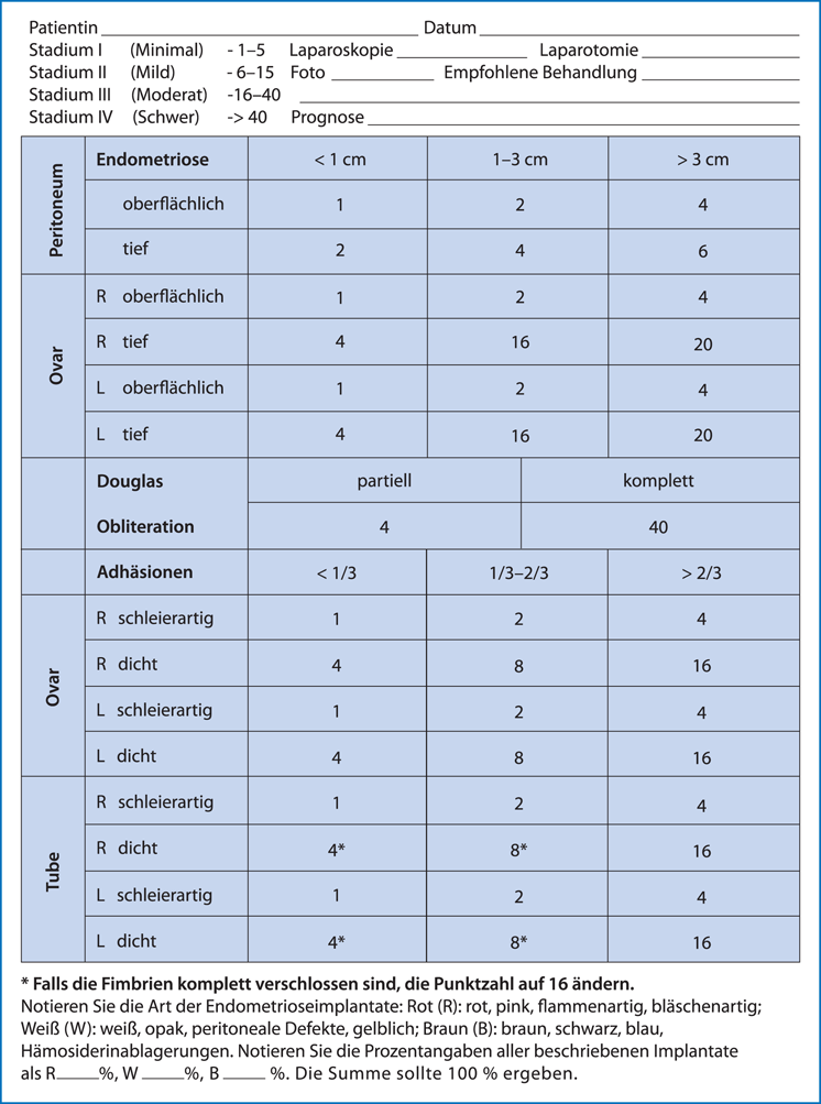 Endometriose | SpringerLink