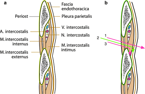 Operative Anatomie: Thoraxwand, Flanke | SpringerLink