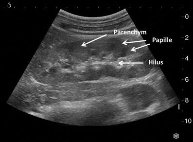 Sonographie der Niere, des Retroperitoneums und der Harnblase ...