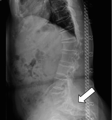 “Construction Plan” of the Bony Pelvis | SpringerLink