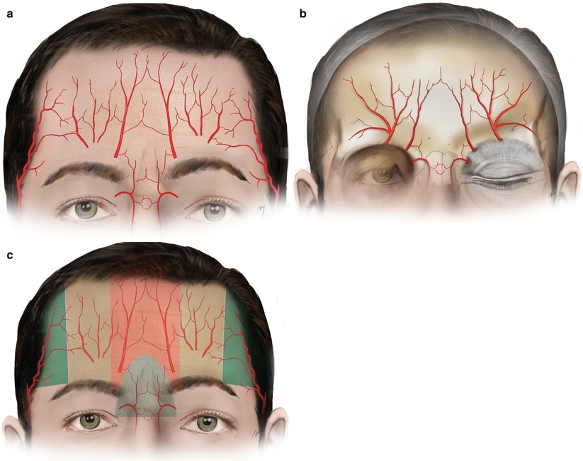 Forehead | SpringerLink