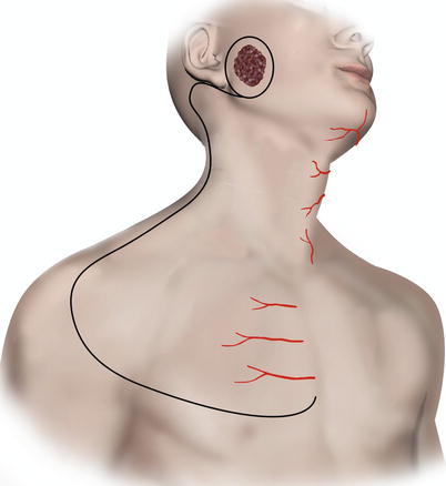 Deltopectoral Region | SpringerLink
