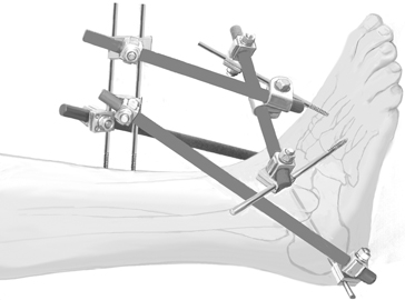 Orthopädie und Traumatologie | SpringerLink
