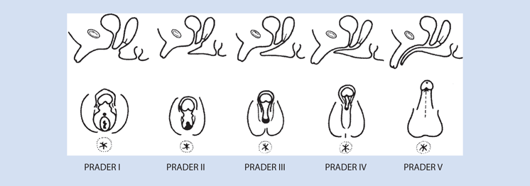 Störungen der sexuellen Differenzierung | SpringerLink