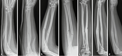 Unterarm | SpringerLink