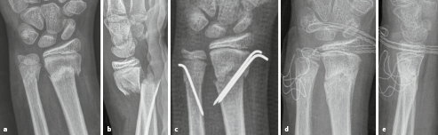 Unterarm | SpringerLink