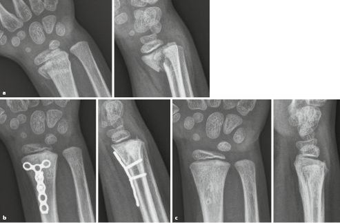 Unterarm | SpringerLink