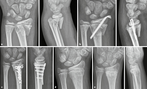 Unterarm | SpringerLink