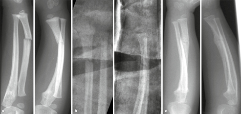 Unterarm | SpringerLink