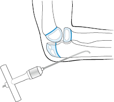 Unterarm | SpringerLink