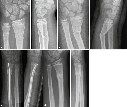 Unterarm | SpringerLink
