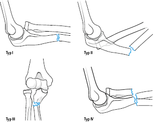Unterarm | SpringerLink