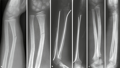 Unterarm | SpringerLink