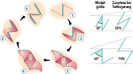 Chirurgische Eingriffe | SpringerLink