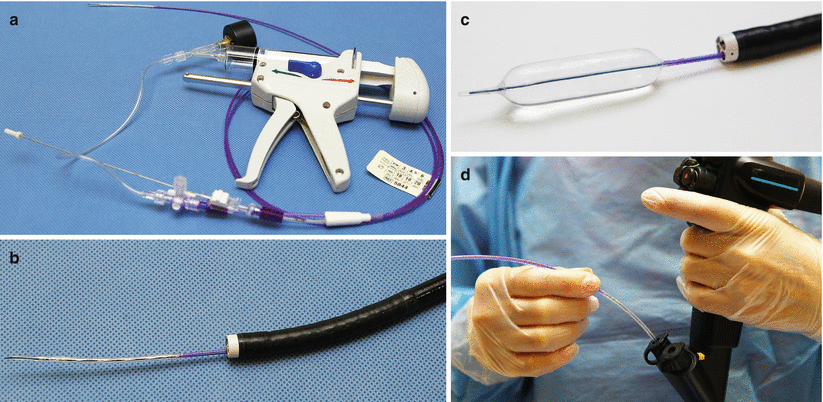 Endoscopic Dilation and Stenting for Pyloric Stenosis | SpringerLink