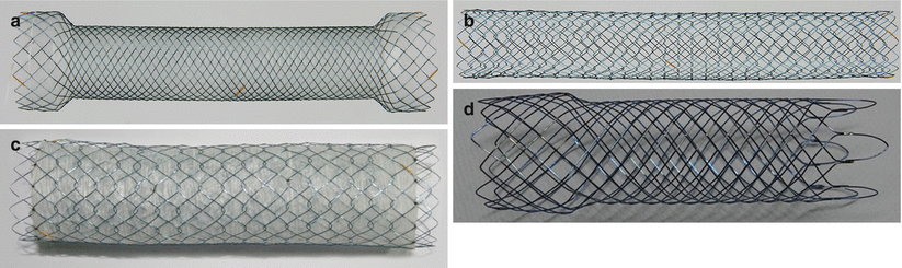 Endoscopic Dilation and Stenting for Pyloric Stenosis | SpringerLink