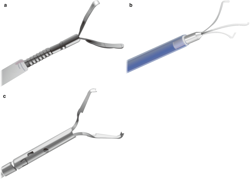 Endoscopic Treatment of Lower Gastrointestinal Bleeding | SpringerLink