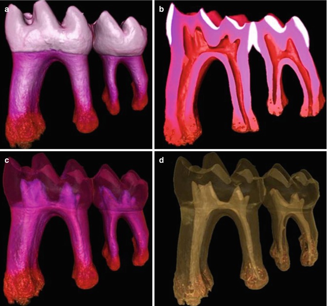 Pulp Anatomy and Characterization of Pulp Cells | SpringerLink